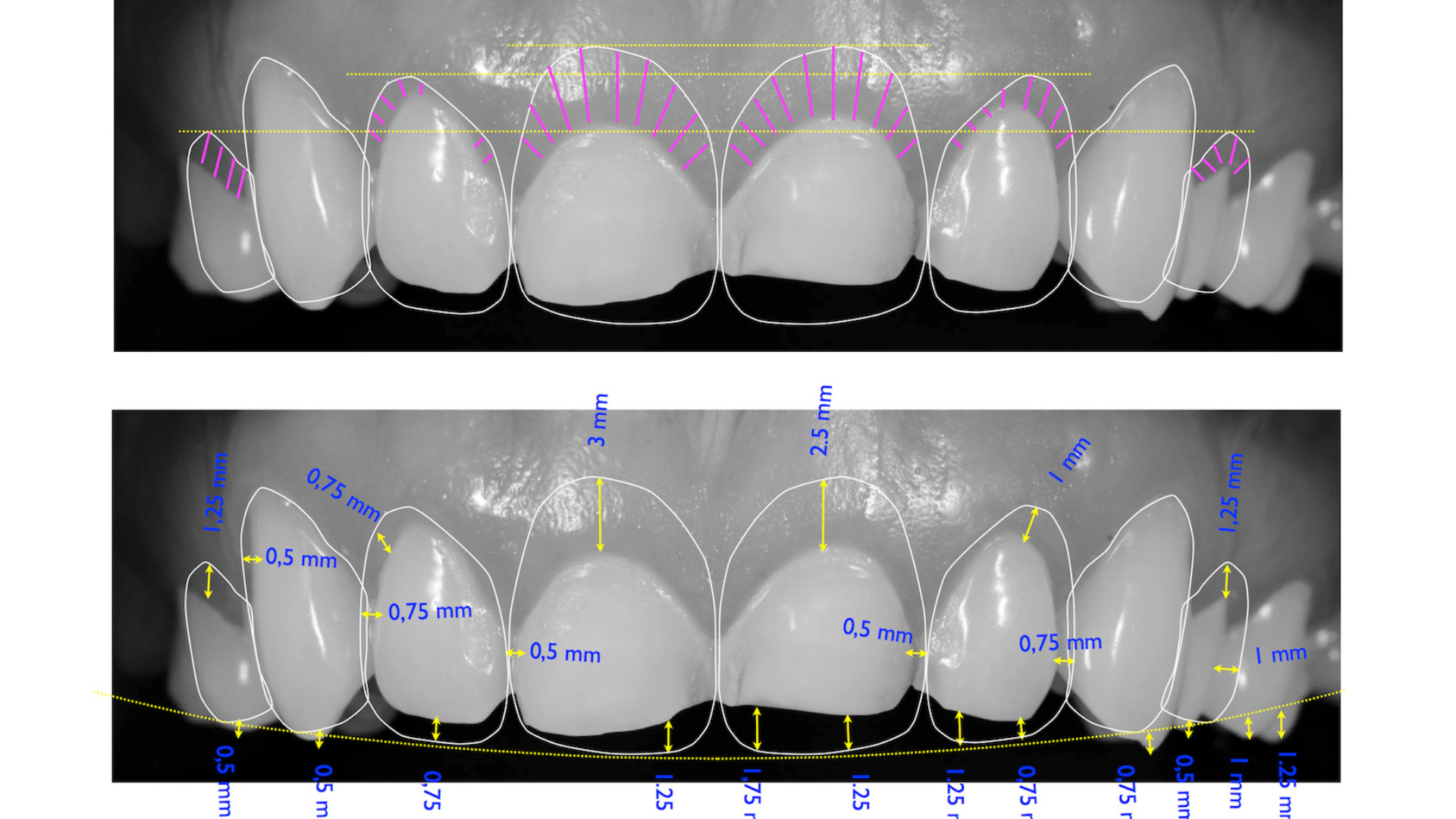 Savršen osmijeh uz moć digitalne stomatologije – preciznije, brže i bez ...